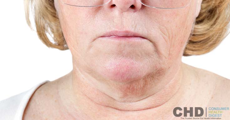 Chest Wrinkles Facts Causes Treatments And Prevention