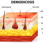 Eyelash Mites: Causes and Treatments to Reduce Eyelash Mites