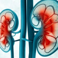 Water Retention: Information, News, Tips, Success Stories and FAQ