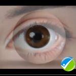 Itchy Skin Around Eyes: Signs, Symptoms, Causes And Treatments