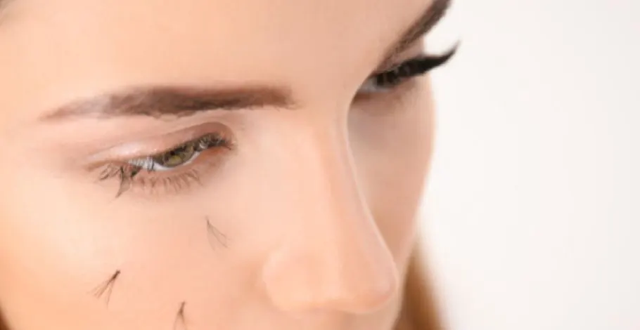 Your Eyelashes Are Falling Out? - Causes and Treatment!
