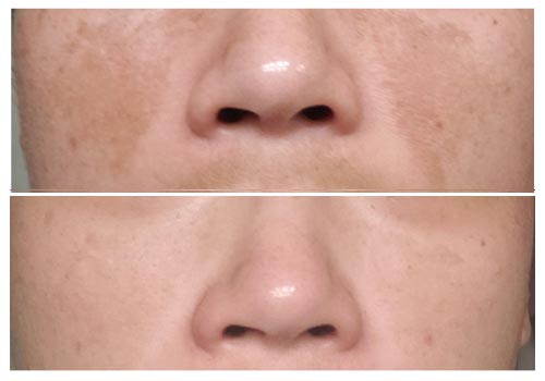 Musely Reviews: Is Musely Face RX Credible & Right for You?