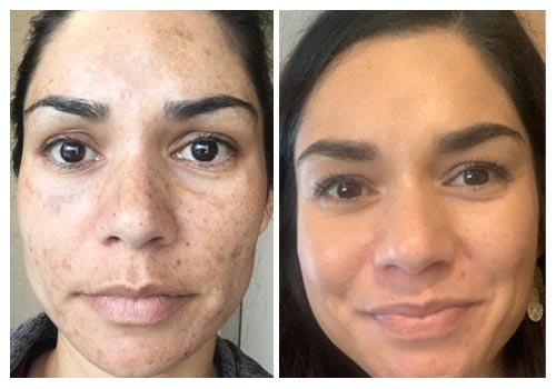 Musely Reviews: Is Musely Face RX Credible & Right for You?