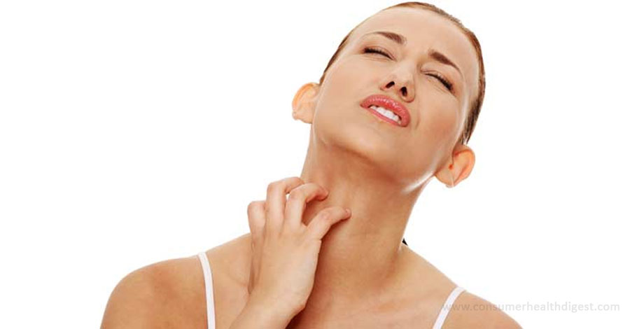 Rash On Neck - Facts, Causes, Symptoms, Treatments and More