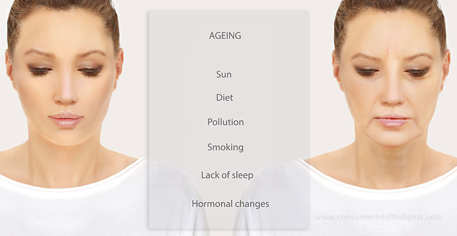 Premature Skin Aging : Symptoms, Causes, Treatment & More