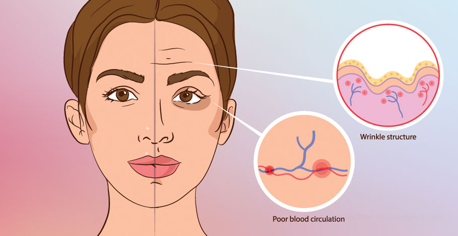 Premature Skin Aging : Symptoms, Causes, Treatment & More